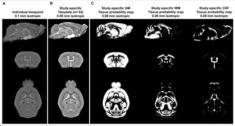 Figures And Data In Learning Related Contraction Of Gray Matter In
