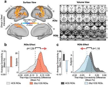 Interaction Derived Effects Resting State Functional Connectivity Of Download Scientific