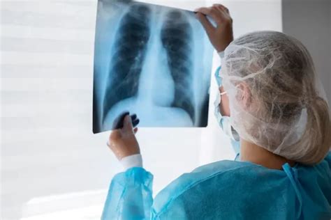 How To Code Multifocal Pneumonia Icd 10