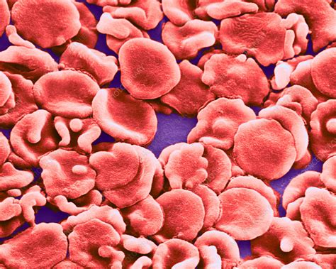 SEM Of Erythrocytes And Echinocytes Stock Image C022 0431 Science Photo Library