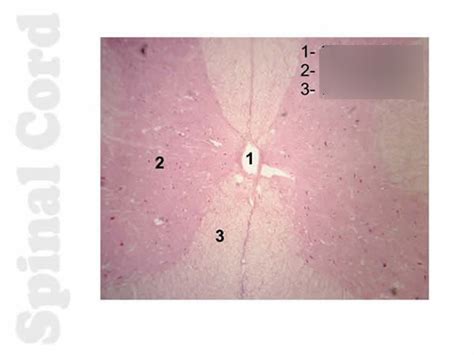 Spinal Cord Slide Diagram Quizlet