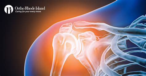 Tuberoplasty With Arthroflex Dermal Patch One Solution For Irreparable Rotator Cuff Tears