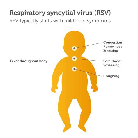 Respiratory Syncytial Virus Rsv Sobi