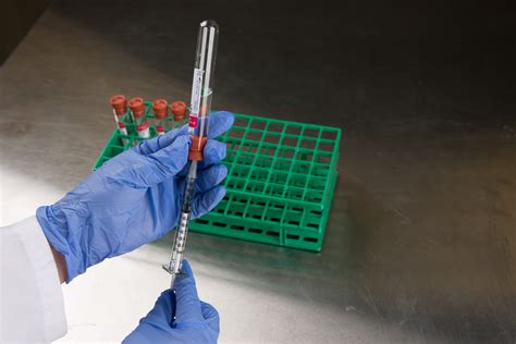 Botulinum Toxin Potency Testing Pacific Biolabs