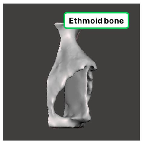 Procedure For Reconstruction Modeling And Fabrication Using Additive