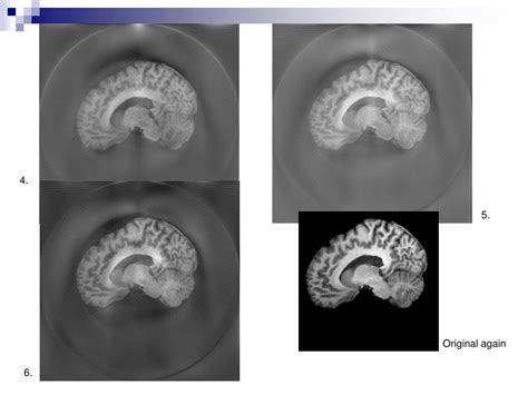 Ppt Image Reconstruction From Projections Powerpoint Presentation Free Download Id 331632
