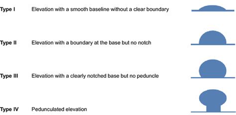 Macroscopic Type Of Subepithelial Tumors According To The Yamada