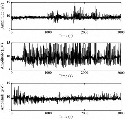 Examples Of EEG Signal Collected For This Study From Three Operators Download Scientific
