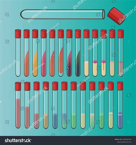 Test Tube Some Bacteria Biochemical Test Stock Vector Royalty Free