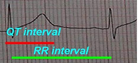 Phimaimedicine 613 QT Prolongation
