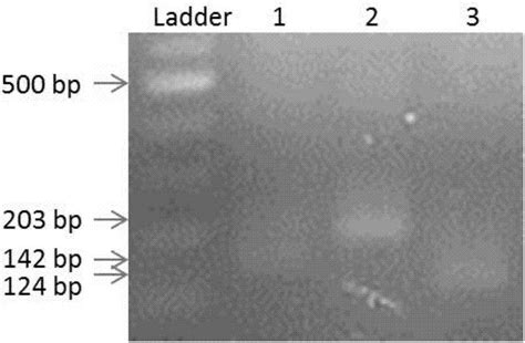 Kit For Detecting Common Pathogenic Bacterium Infection Eureka Patsnap