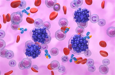 Current Treatment Approaches For Relapsed Refractory Diffuse Large B Cell Lymphoma