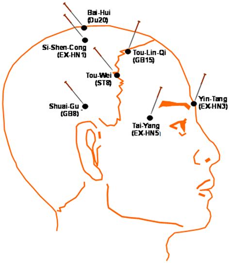 Acupoints Used In Dense Cranial Electroacupuncture Stimulation Dceas