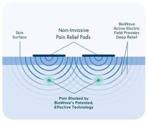 Frequency Conduction Block Theory Download Scientific Diagram