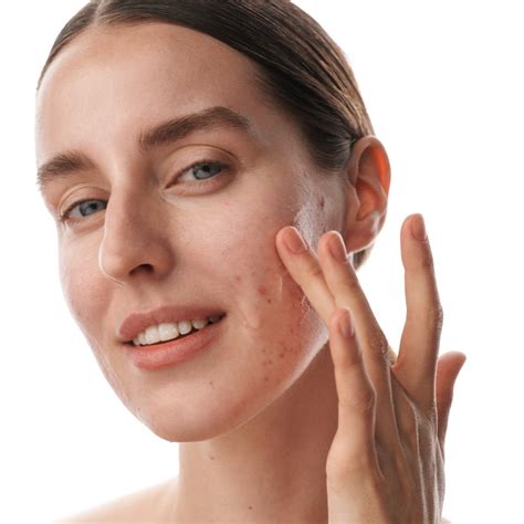 Aktyvusis Veido Gelis Nuo Spuogų Su Pieno Ir Salicilo Rūgštimis Moon