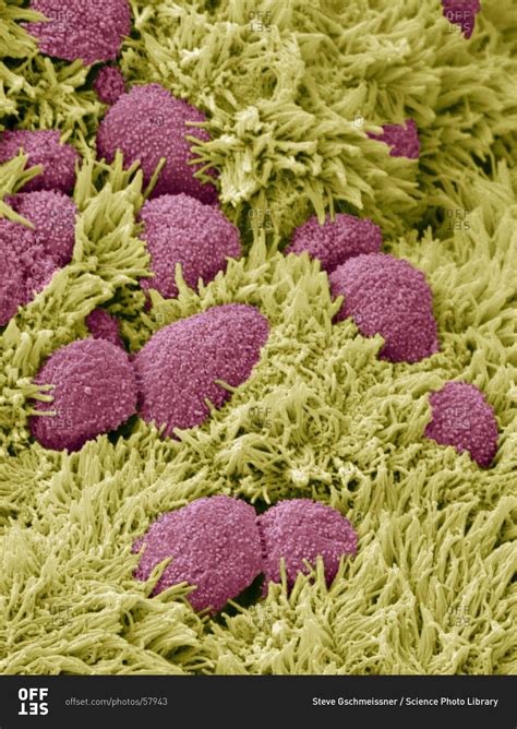 Color Scanning Electron Micrograph Of The Surface Of A Fallopian Tube Showing Non Ciliated