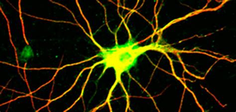 Researchers Develop Method For Mapping Neuron Clusters