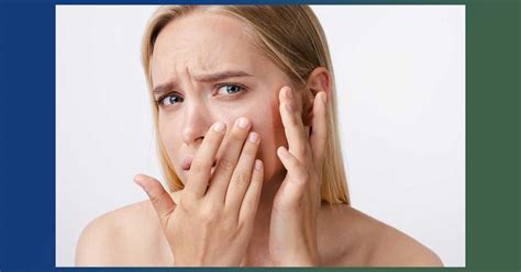 Най често срещаните кожни проблеми и как да ги предотвратим Здраве Орг