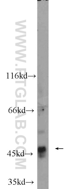 Bmp10 Antibody 22858 1 Ap Proteintech