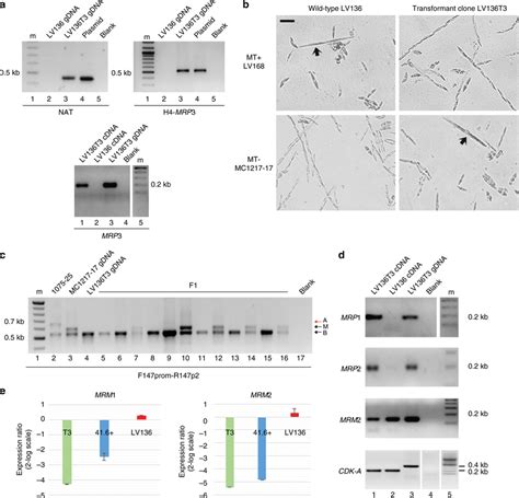 Sex Reversal In The MT LV136 Transformed Strain Overexpressing MRP3 A Download Scientific