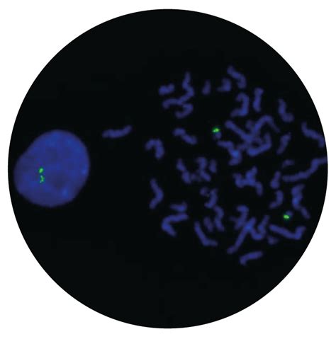 Cytocell Runx1 Green Fish Probe Cytocell Runx1 Green Fish Probe