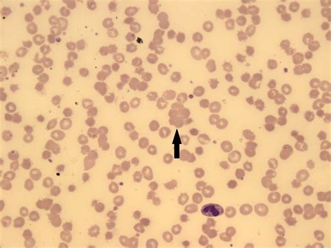 Agglutination Microscope At Samantha Atherton Blog