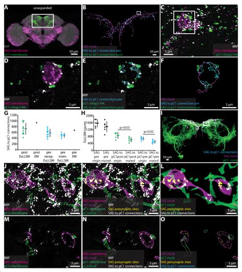 Quantifying Connectivity Using ExLLSM A Unexpanded Female Brain With Download Scientific
