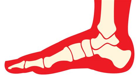 Broken Toe Images Illustrations Royalty Free Vector Graphics And Clip