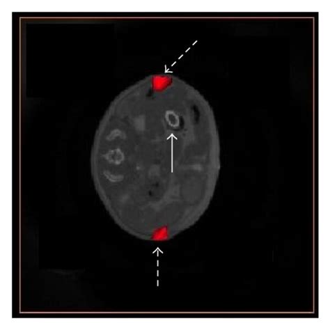 The Reconstructed Results With Coarse Mesh A B C Double Mesh D Download Scientific