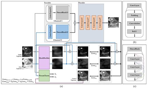 Multi Task Learning Approach Using Dynamic Hyperparameter For Multi
