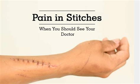 Stitches Blog Axis Orthopedic Hospital Blog Axis Orthopedic