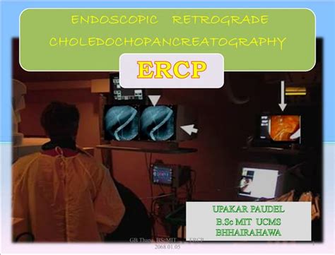 Ercp Procedure Ppt