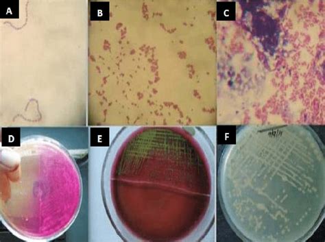 Isolation And Identification Of Staphylococcus Spp Streptococcus And Download Scientific
