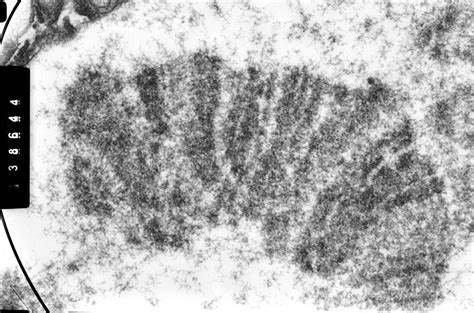 Drosophila Melanogaster Polytene Chromosome Cil 35388 Doccheck