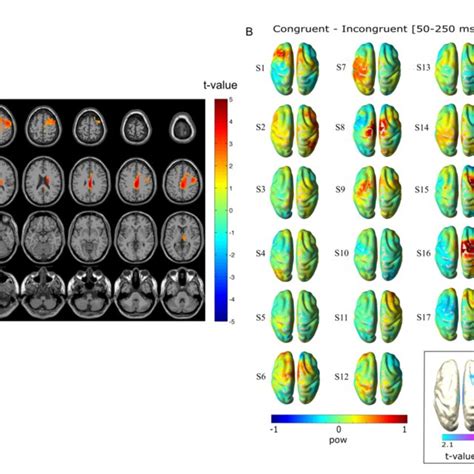 Syllable Congruency Effect A Topographic Distribution Of The Download Scientific Diagram
