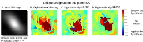 Figure 1 From Local Interpretable Model Agnostic Explanations For