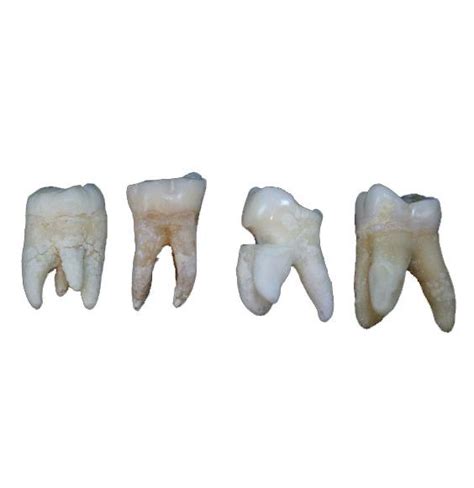 Three Tooth Models On White Background