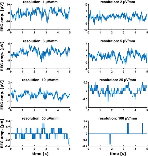 Five Second EEG Samples Recorded During The Different EEG Amplitude Download Scientific Diagram