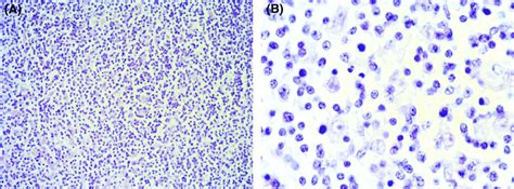 Hande Staining Of The Right Cervical Lymph Node A 100× Magnification Download Scientific