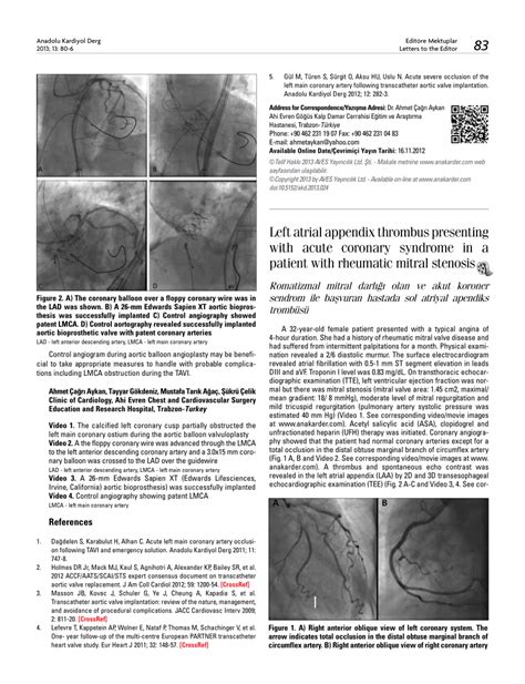 Pdf Left Atrial Appendix Thrombus Presenting With Acute Coronary
