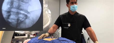 Radiofrequency Ablation Arthurcare