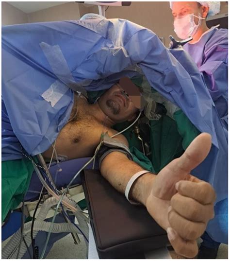 Brain Glioma Surgery By Craniotomy With The Patient Awake Report Of 2 Cases Surgical And