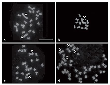 Root Tip Squashes Of S Latifolia Plants A Starting Material For Download Scientific Diagram