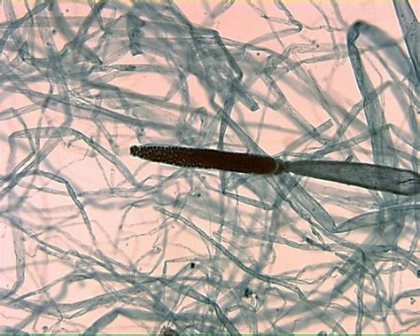 Protists Lab Flashcards Quizlet