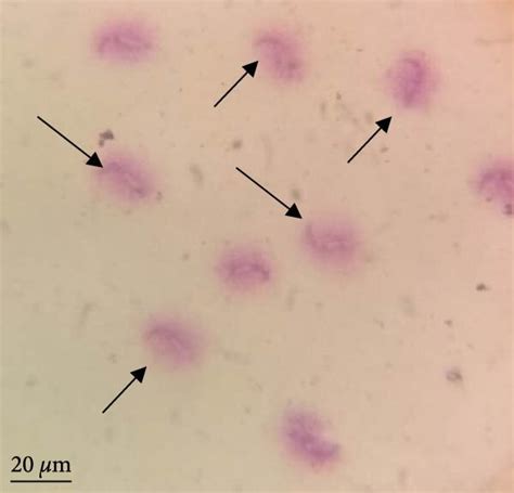 Dna Fragmentation In Rat Sperm A Fragmented Sperm Dna And B Download Scientific Diagram