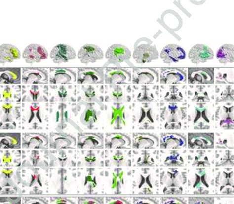 Three Dimensional 3d Callosal Connections Projecting To All Wm Fns Download Scientific