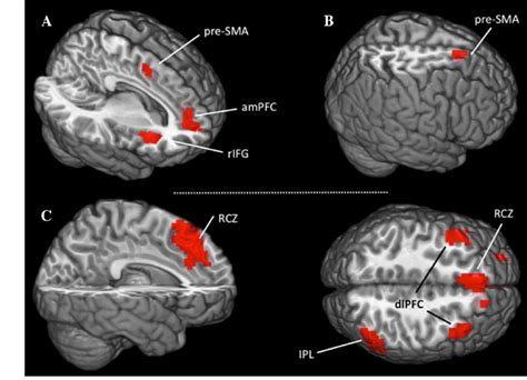 Activation Maps Of The Whole Brain Contrasts Comparing A Inhibition