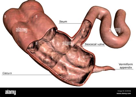 Ileocecal Valve Diagram