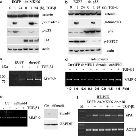 Schematic Presentation Of The Tgf Alk5 Signaling Pathway In Tumor Download Scientific Diagram