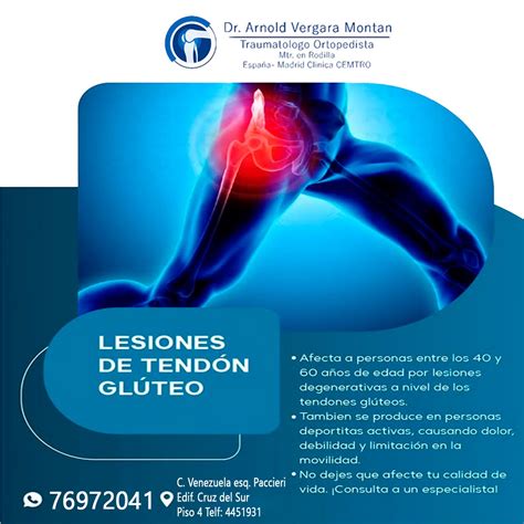 Dr Lesiones De Tendón Glúteo 👉 ¿sabes Qué Es La Tendinopatía Glútea